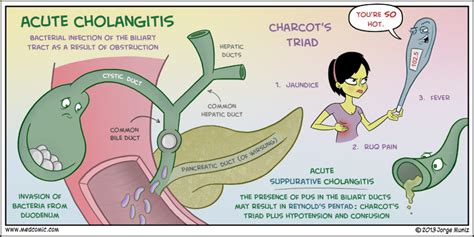 Acute Cholangitis Infographic Rebel Em Emergency Medicine Blog