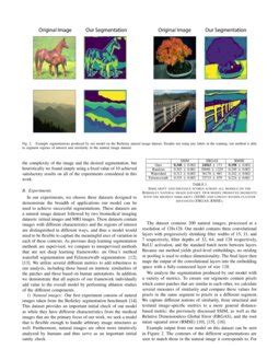 Cuts A Fully Unsupervised Framework For Medical Image Segmentation Deepai