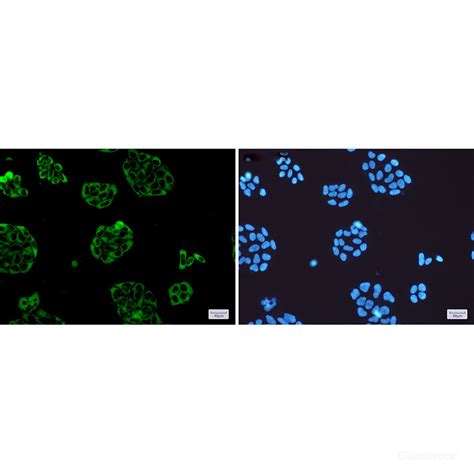 High Affinity And Specificity Recombinant Vinculin Monoclonal Antibody