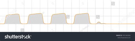 Capnography Waveform Monitoring During Apnea Stock Illustration 1931262926 Shutterstock