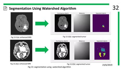 Brain Tumor Detection Using Convolutional Neural Network Pptx Brain And Nervous System