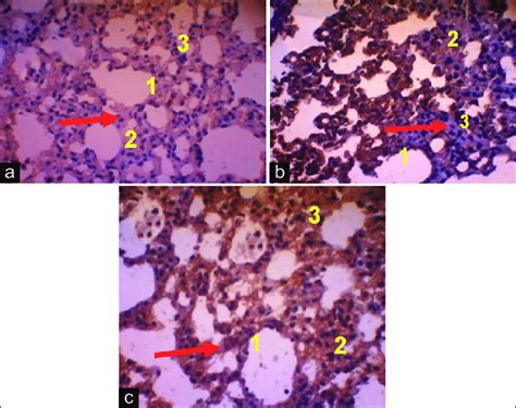 Overview Of Immunohistochemistry Expressions Of Cyt C Bax And Caspase Download Scientific