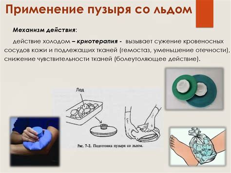 Методы воздействия на кровеносную систему - презентация онлайн