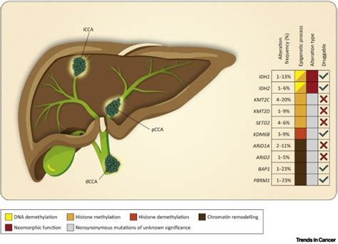 Cholangiocarcinoma Type