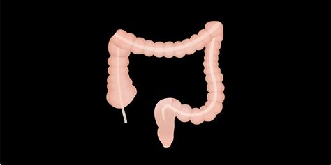 Complications Of Segmental Colectomy Surgery 101