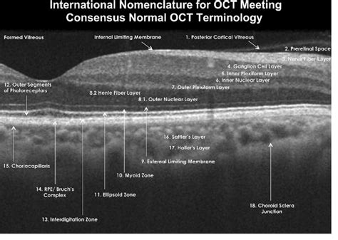 Figure 1 From Proposed Lexicon For Anatomic Landmarks In Normal Posterior Segment Spectral