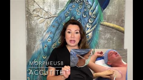 Hyperhydrosis Aka Excessive Sweating Youtube