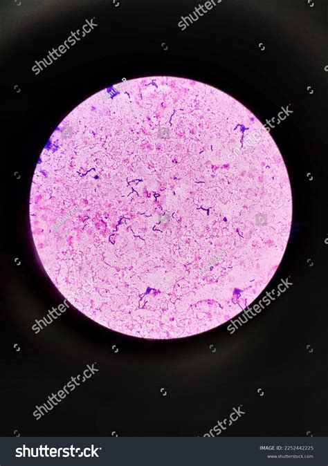Streptococcus Pyogenes Gram Stain Picture Hemoculture Stock Photo Shutterstock