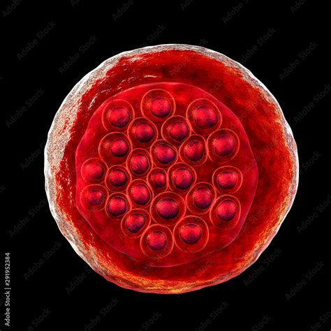 The Malaria Infected Red Blood Cell 3d Illustration Showing Malaria