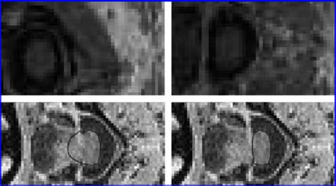 18 See Color Insert Following Page 370 Axial Slices Of A Spinal