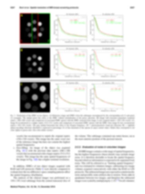 Solution A Novel Approach To Evaluate Spatial Resolution Of Mri