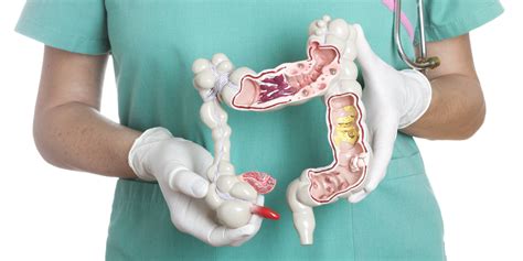 Researchers Discover New Cause Of Crohns Disease