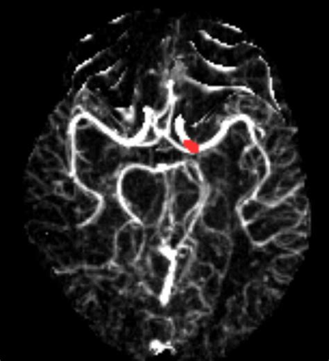 07 Ct Angiogram Chss Elearning