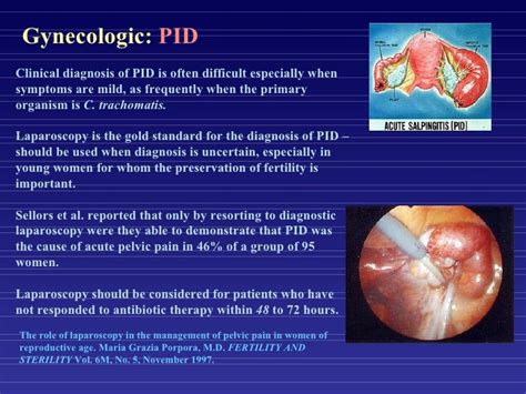Diagnostic Laparoscopy For Pelvic Disorders