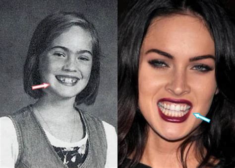 Has Megan Fox Had Cosmetic Surgery