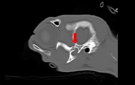 Tmj Luxation Treatment Jaw Dislocation