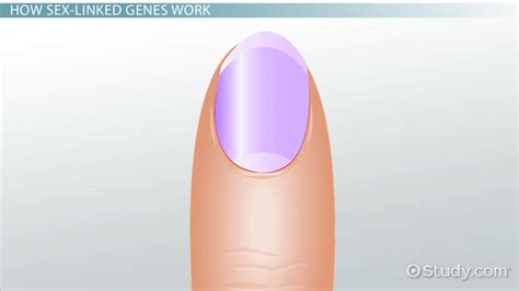 Sex Linked Traits On The X And Y Chromosomes Video Study Com