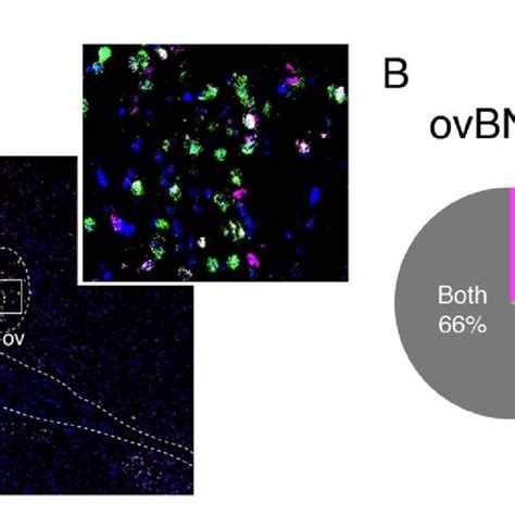 Expression And Co Localization Of Pdyn And Nts Mrna In The Ovbnst A