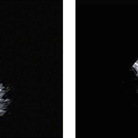 Ultrasound Flow Imaging Of The Heart Download Scientific Diagram