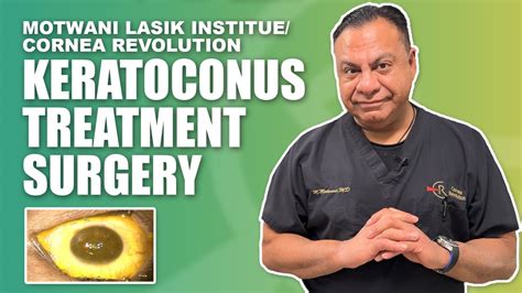 Keratoconus Treatment And Laser With The Create Protocol Dr Manoj Motwani