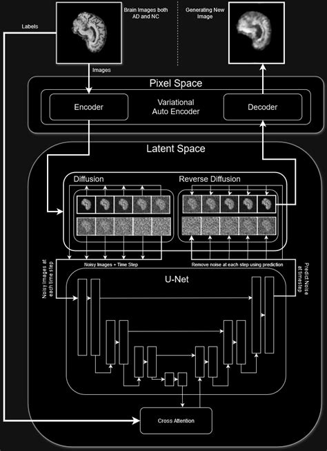 GitHub SixLeopard Stable Diffusion Custom Stable Diffusion Model For ADNI Dataset Generates