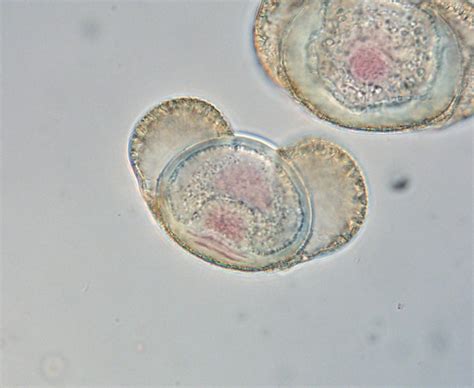Pine Pollen Microscope