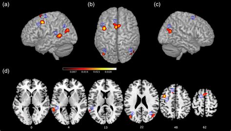 Clusters Of Significant Activation Derived From The Production Download Scientific Diagram