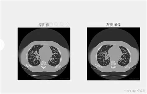 基于matlab分水岭分割算法进行图像分割matlab 用分水岭算法分割图像 Csdn博客