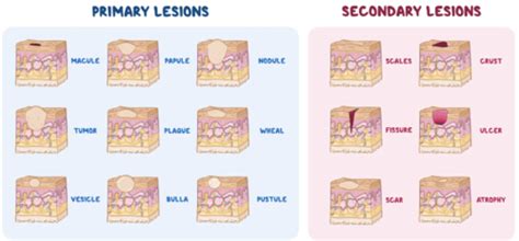 Patho Integumentary Flashcards Quizlet