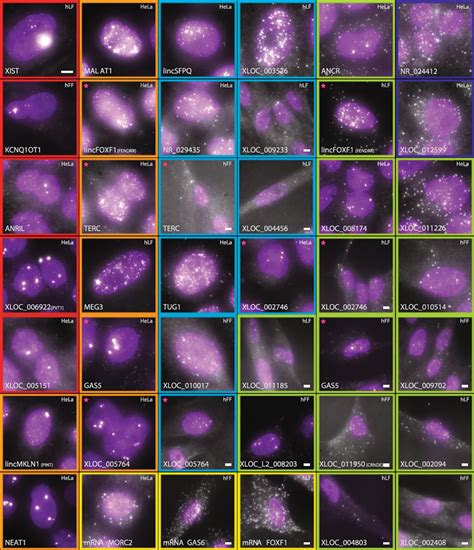 figure 16 4 [subcellular and subnuclear localization of ] rna
