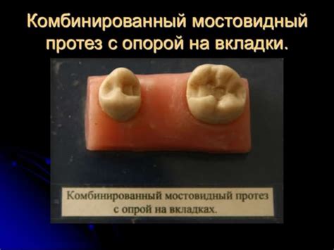 несьёмные протезы | PPT