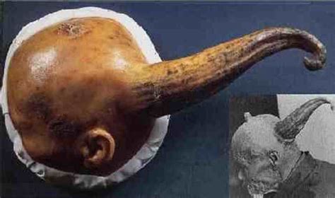 Horn Growing Out Of Human Head At Kurt Scott Blog