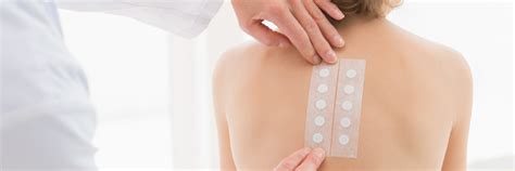 Exeter Skin Allergy Patch Testing With Dermatologist