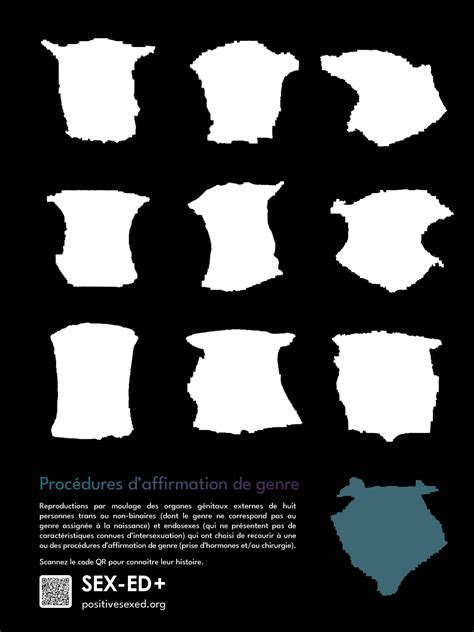 Poster Procédures Daffirmation De Genre Sex Ed