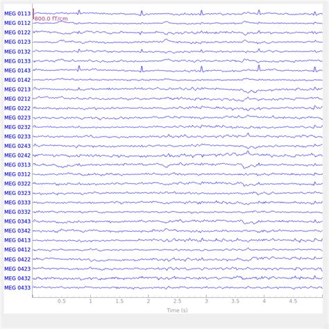 Overview Of MEG EEG Analysis With MNE Python MNE Documentation