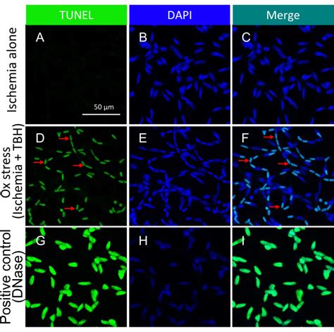 An Assay To Detect Protection Of The Retinal Vasculature From Diabetes