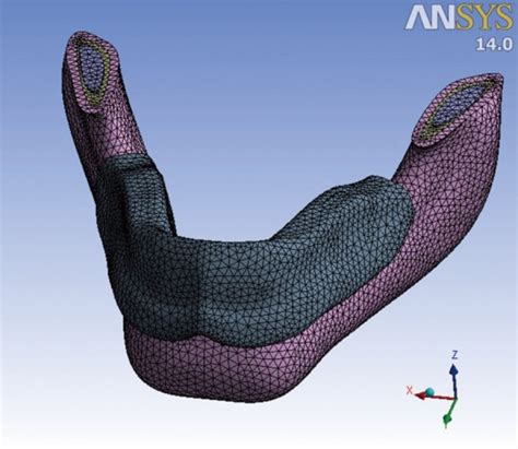 the full assembly after meshing with tetrahedron element type