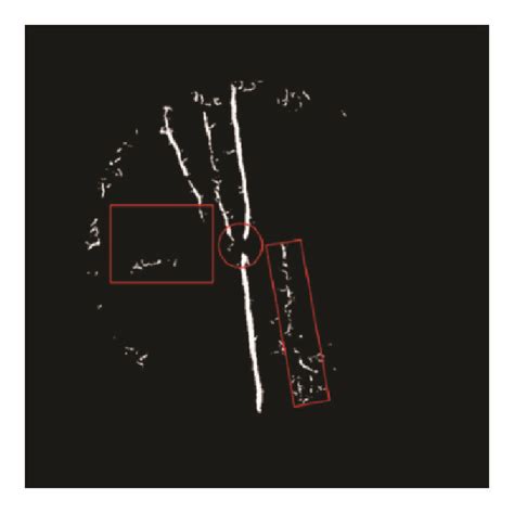 The Results Of Multiscale Hessian Fracture Filtering Download