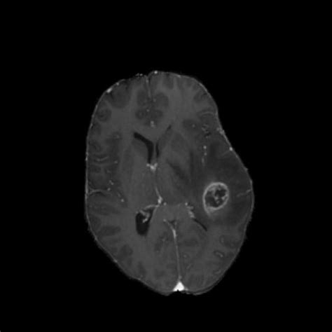 Francescoaxial Mri · Datasets At Hugging Face
