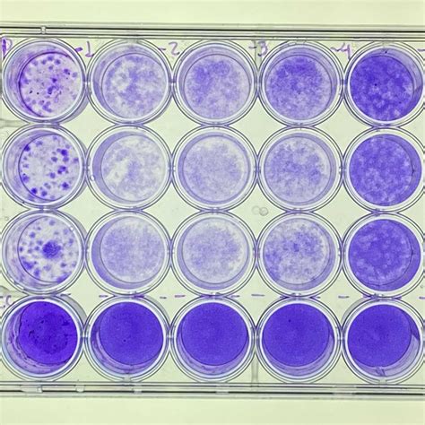 Denv 2 Infection