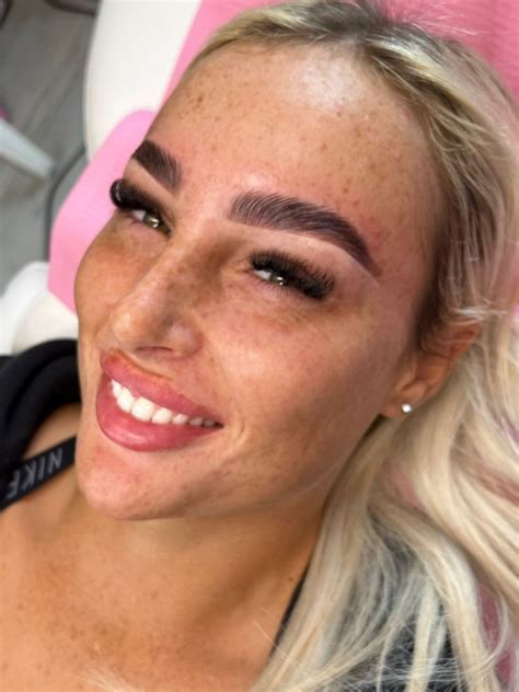 Why Should I Patch Test