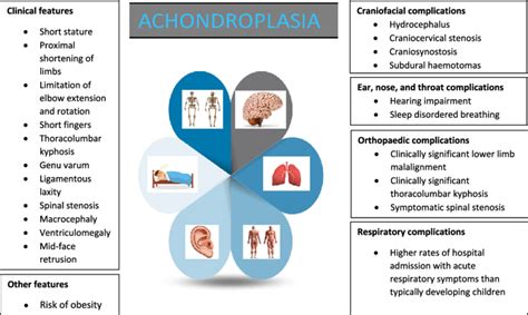 Achondroplasia Symptoms Of The Disorder Achondroplasia Medlineplus