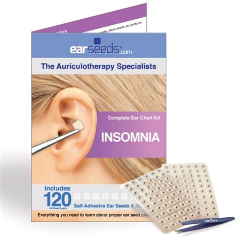 Ear Acupuncture Insomnia At Lorelei Rios Blog