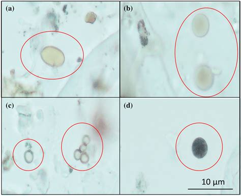 Fungi Under Light Microscope