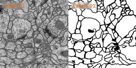 Pytorch深度学习实战教程UNet模型训练 腾讯云开发者社区 腾讯云