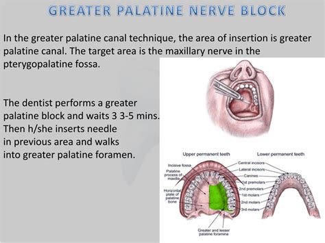 Ppt Trigeminal Nerve Powerpoint Presentation Free Download Id2586490