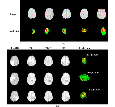 display of segmentation results in the validation set a example