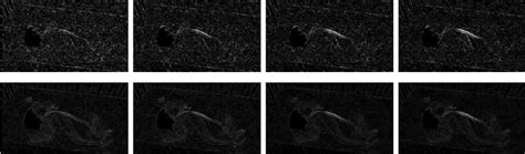 Absolute Difference Results Of Eulerian Motion Magnification With α