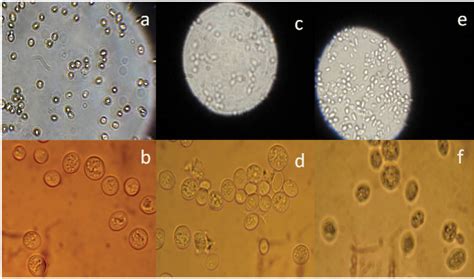 What Is Yeast Isolation At Maria Spillman Blog