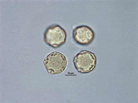 Pollen Detection Object Detection Dataset By 3a Polytech